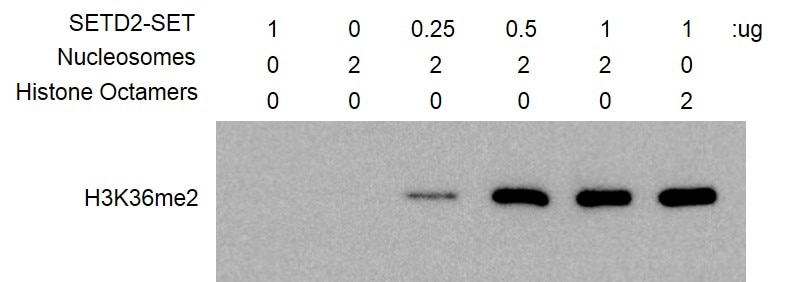 Recombinant SETD2 (1392-2564) protein | Proteintech