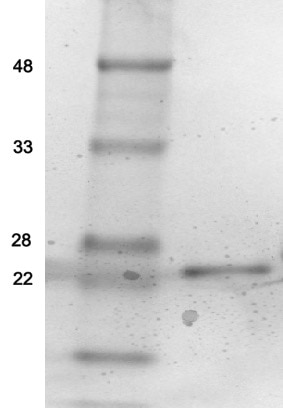 Recombinant Sortase (2A.9) protein | Proteintech
