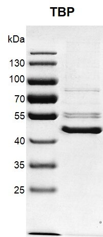 Recombinant TBP protein | Proteintech
