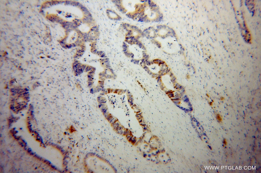 SCNN1G antibody (13943-1-AP) | Proteintech