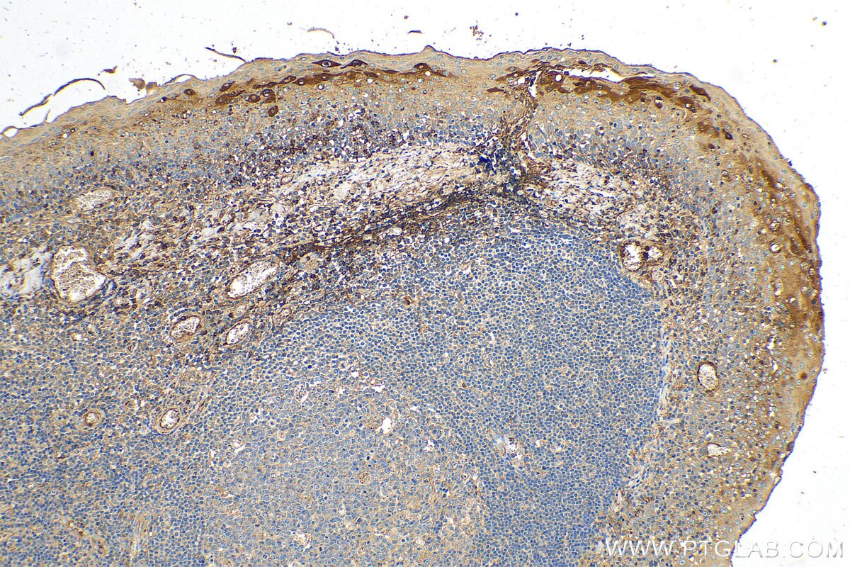 SERPING1/C1 Inactivator antibody (12259-1-AP) | Proteintech