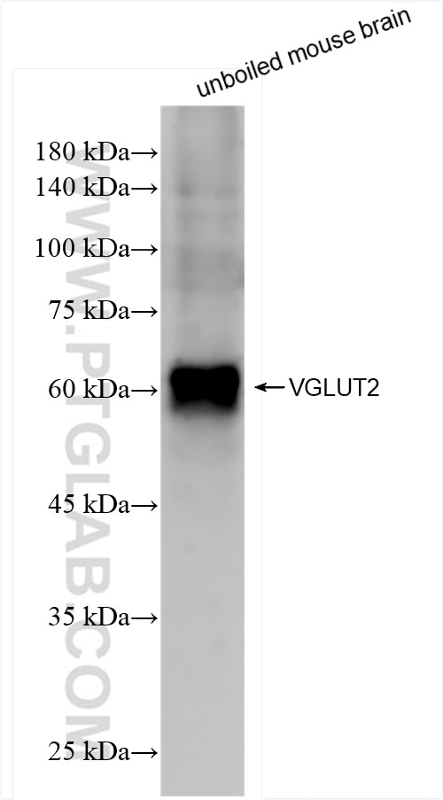 VGLUT2 antibody (84083-2-RR) | Proteintech