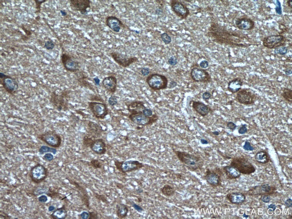 VGLUT1 antibody (55491-1-AP) | Proteintech