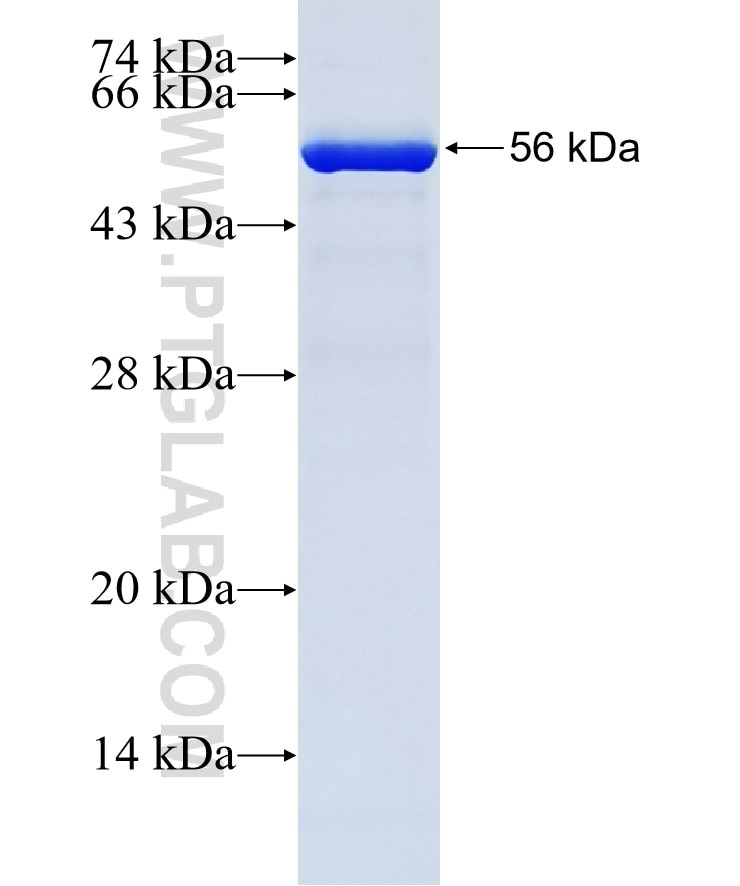 SLC38A10 Fusion Protein Ag38490 | Proteintech