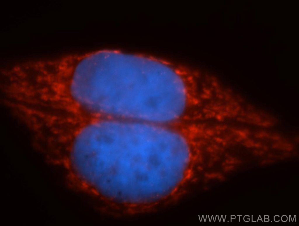 SLC38A3 Fusion Protein Ag5512 | Proteintech