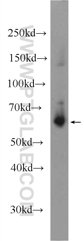 SLC38A3 antibody (14315-1-AP) | Proteintech