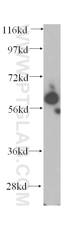 SLC38A3 antibody (14315-1-AP) | Proteintech