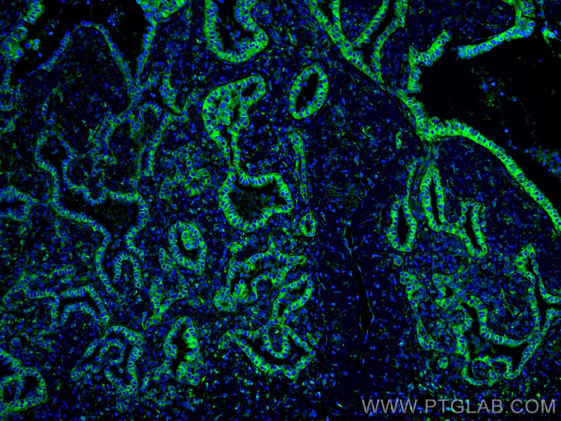 SLC44A1 antibody (14687-1-AP) | Proteintech