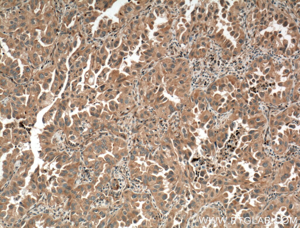 SLC44A1 antibody (14687-1-AP) | Proteintech