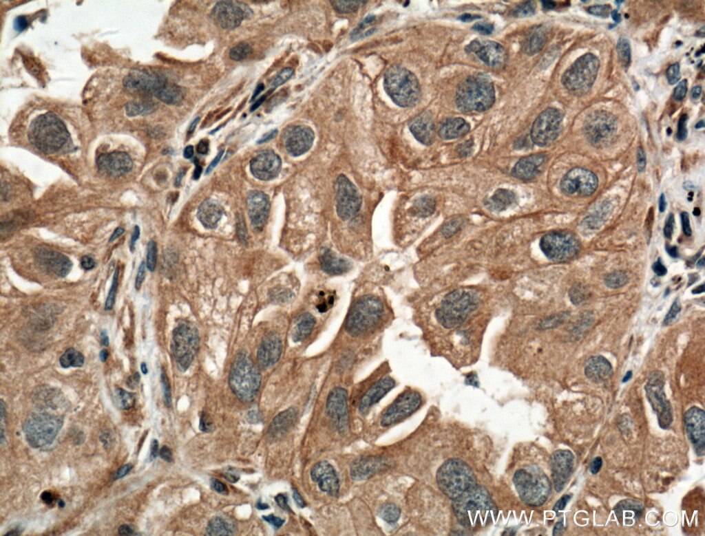 SLC44A1 antibody (14687-1-AP) | Proteintech
