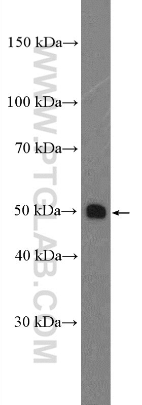SLC44A1 antibody (14687-1-AP) | Proteintech