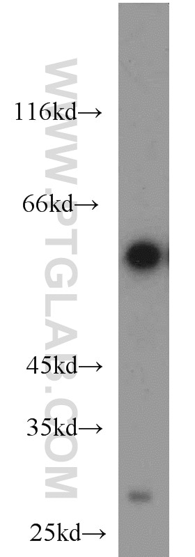 SLC45A2 antibody (10453-1-AP) | Proteintech
