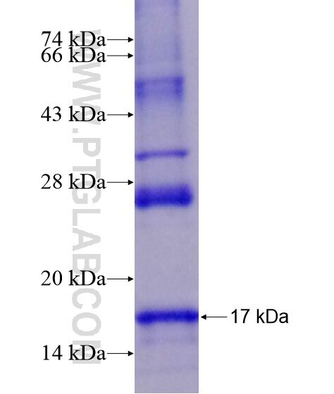 SLC5A2 Fusion Protein Ag19047 | Proteintech