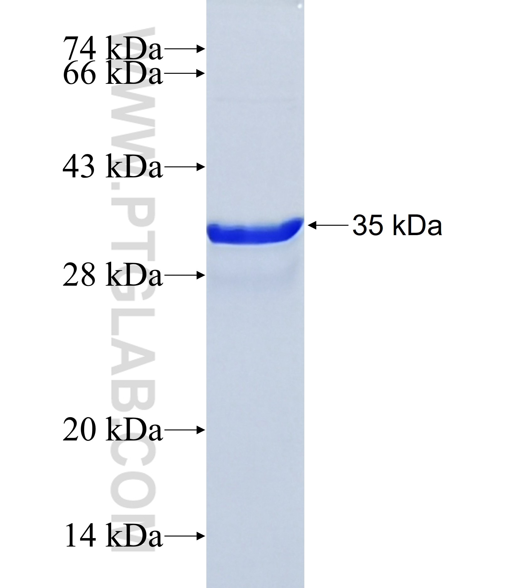 SLC5A3 Fusion Protein Ag32195 | Proteintech