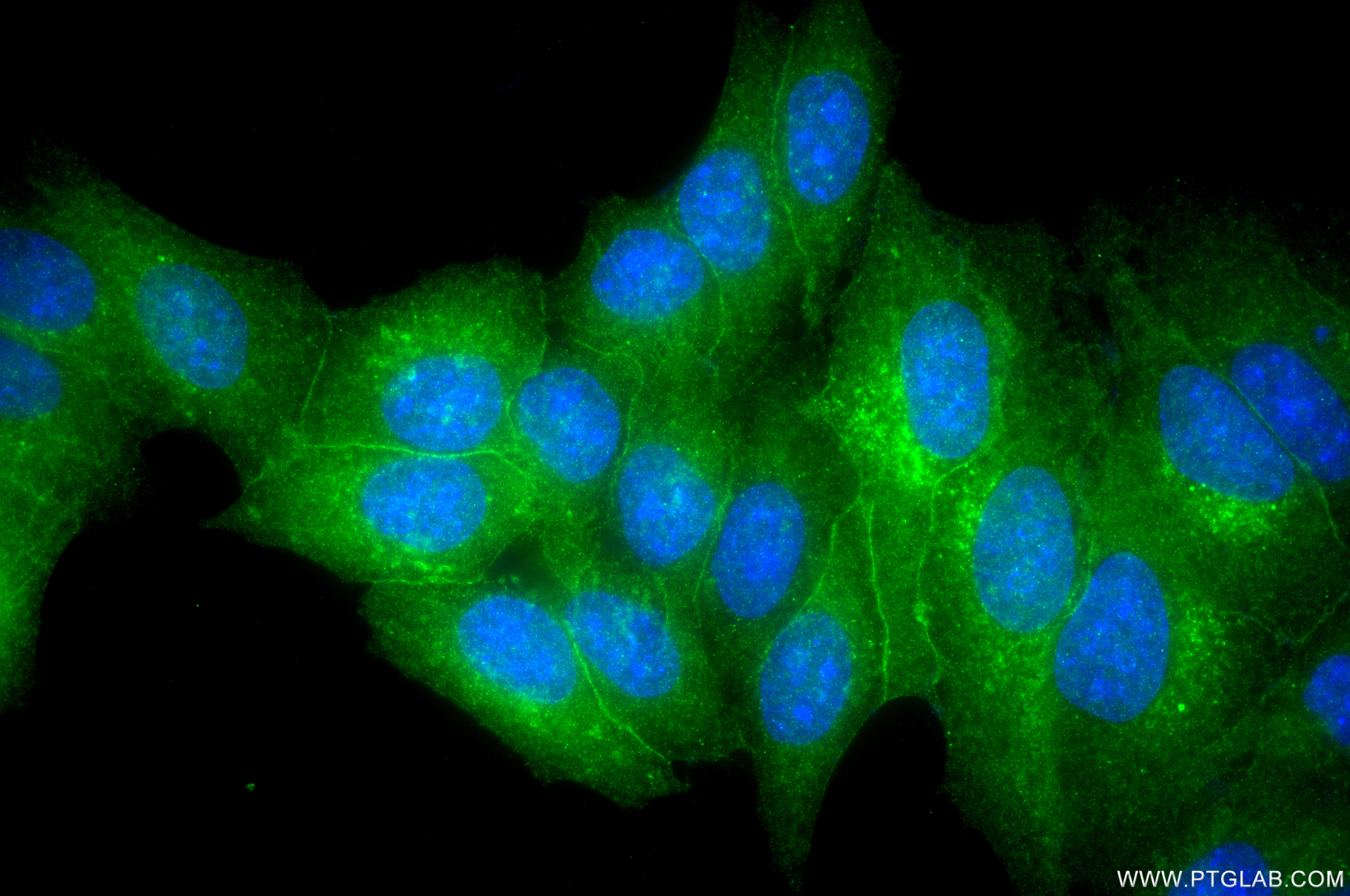 SLC7A11/xCT antibody (82115-3-PBS) | Proteintech