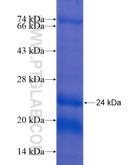 SLCO3A1 Fusion Protein Ag20379 | Proteintech
