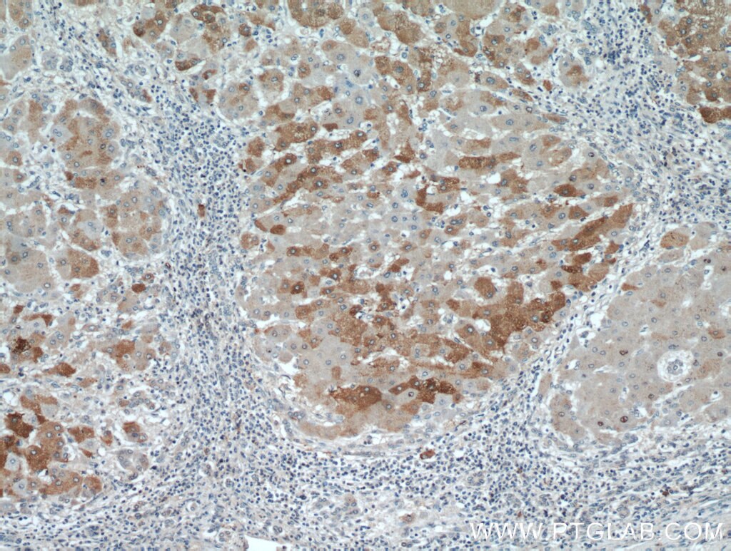 SLITRK6 Fusion Protein Ag15701 | Proteintech