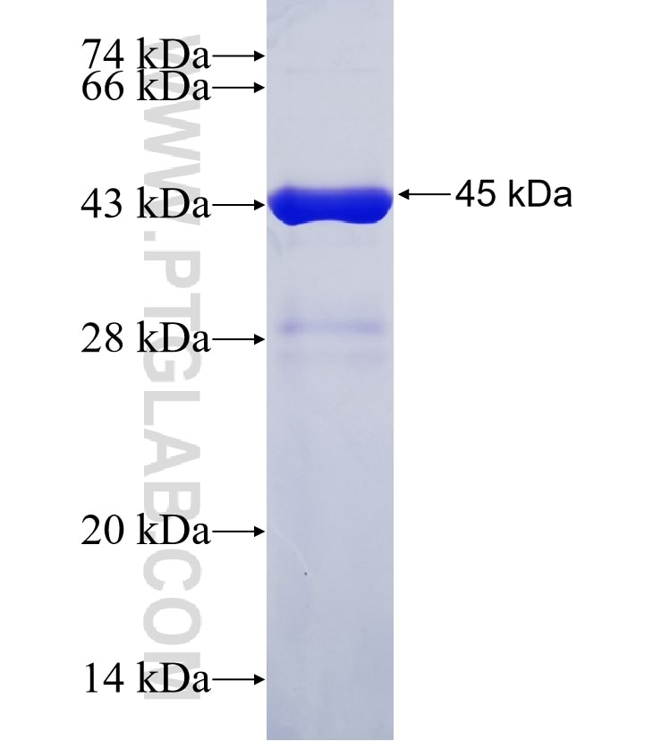 SLITRK6 Fusion Protein Ag34815 | Proteintech