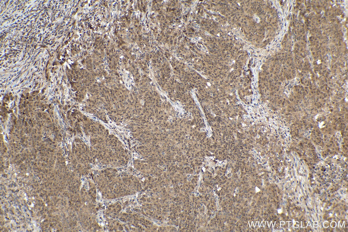 SMAD2 antibody (12570-1-AP) | Proteintech