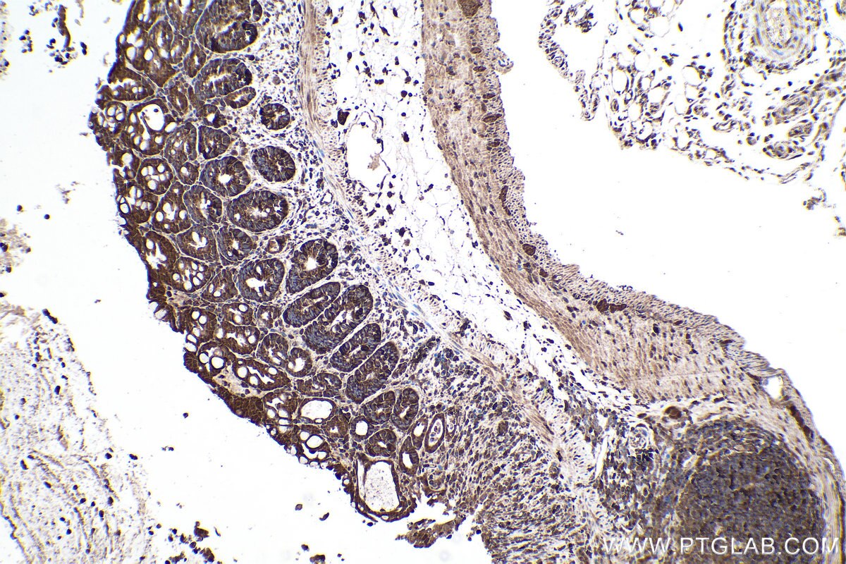 SMAD2 antibody (12570-1-AP) | Proteintech