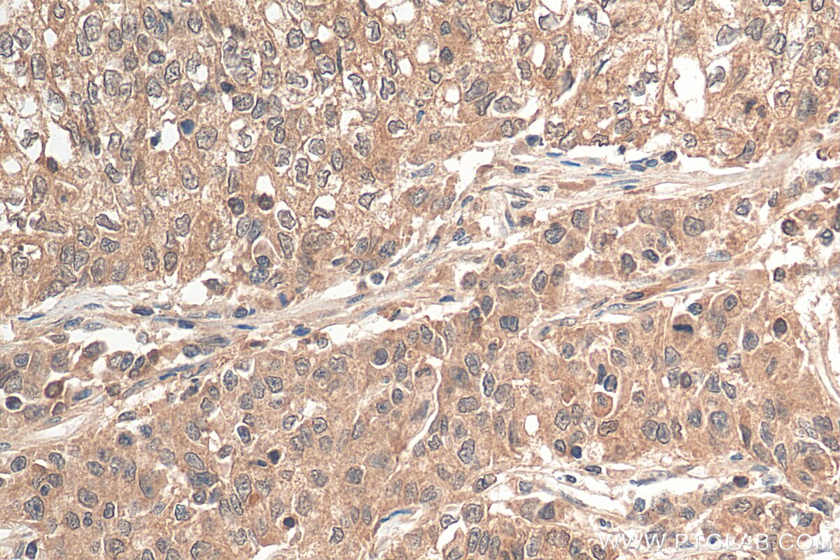 SMAD2 antibody (12570-1-AP) | Proteintech