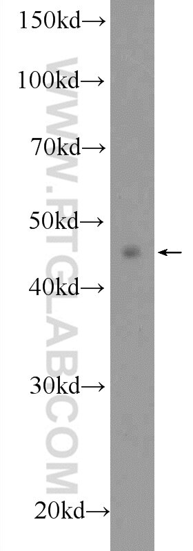SMAD7 antibody (25840-1-AP) | Proteintech