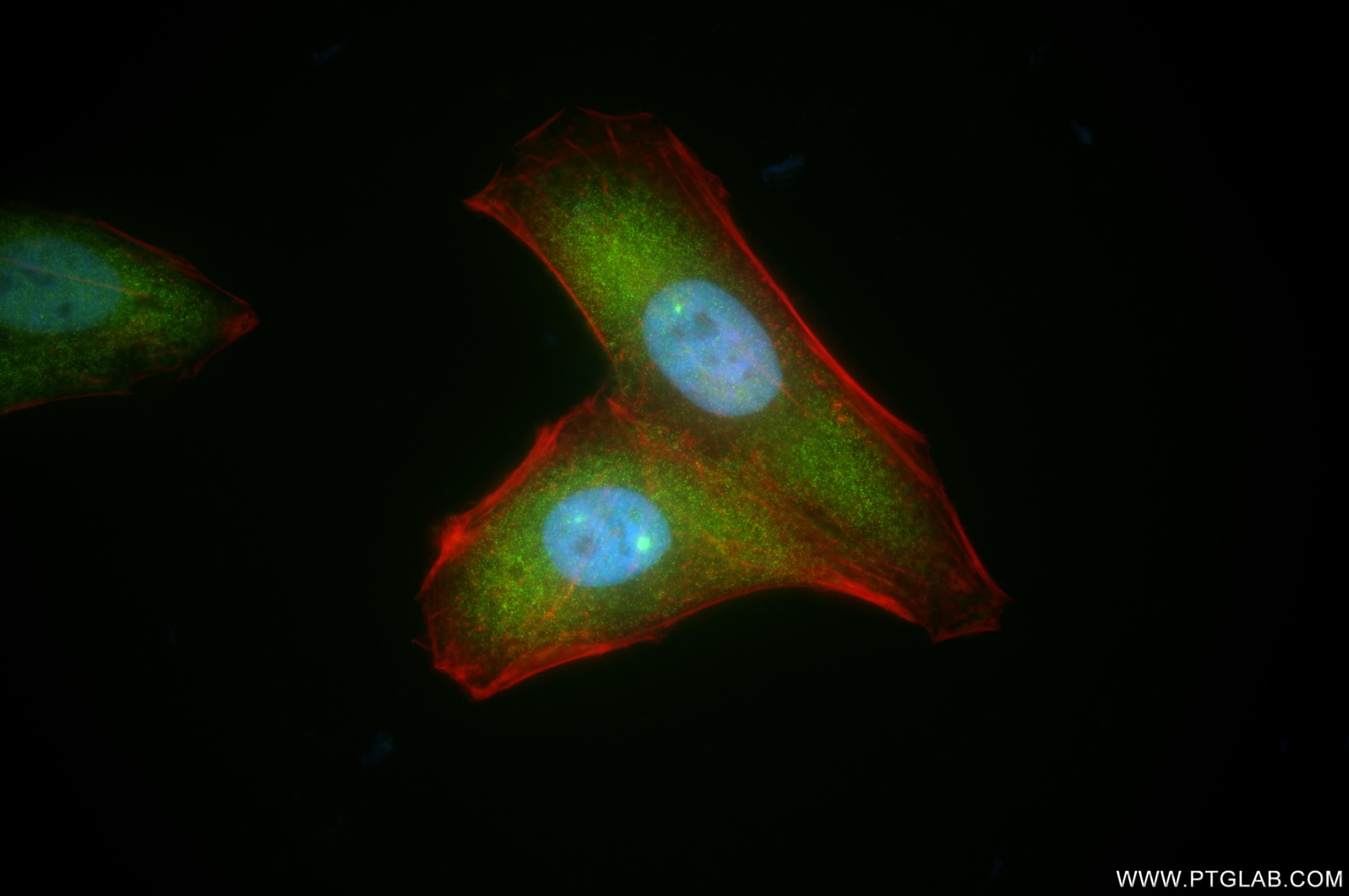 SMN antibody (86668-2-RR) | Proteintech