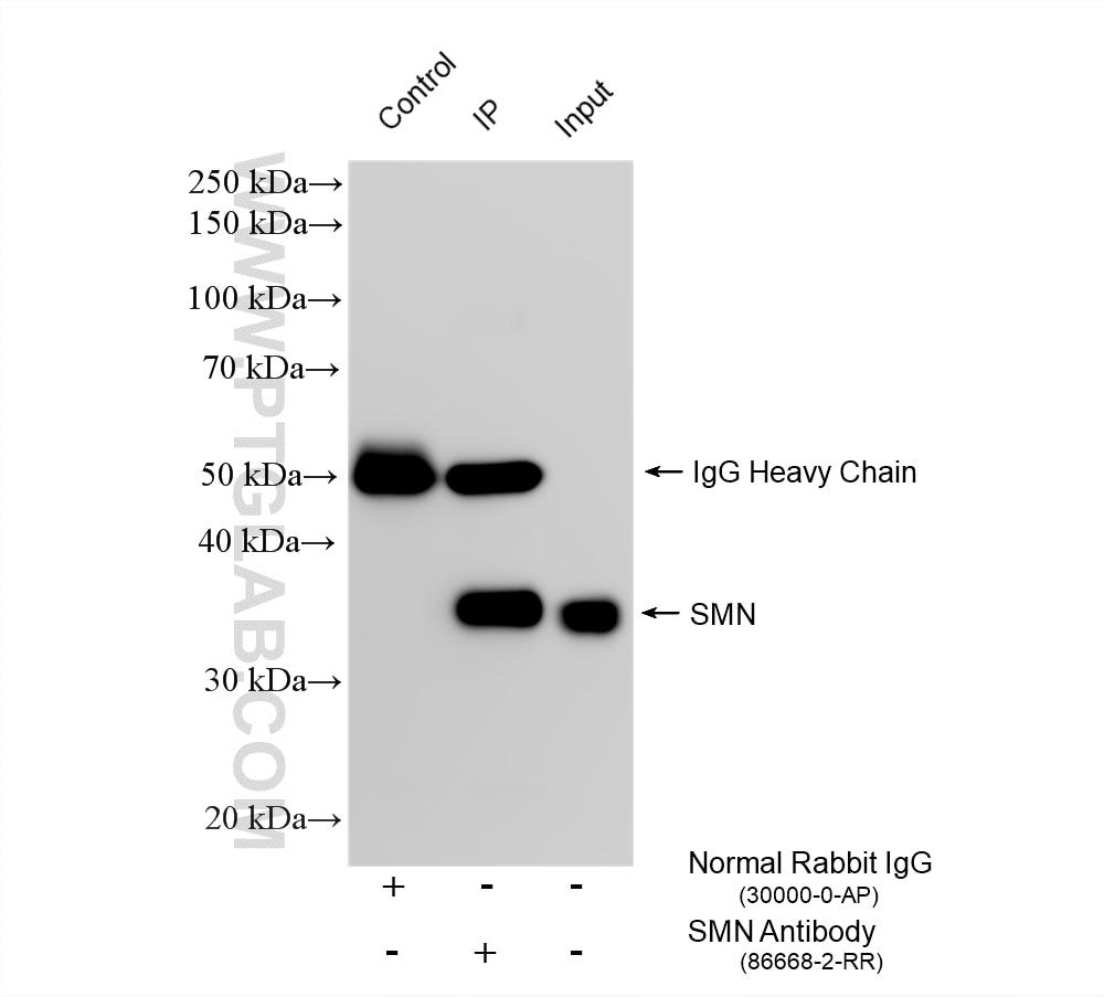 SMN antibody (86668-2-RR) | Proteintech