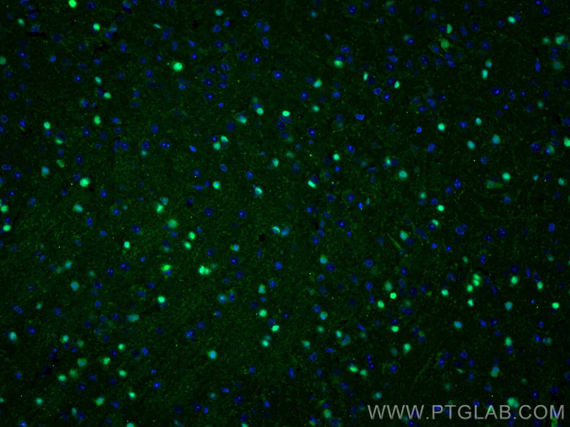SOX10 antibody (66786-1-Ig) | Proteintech