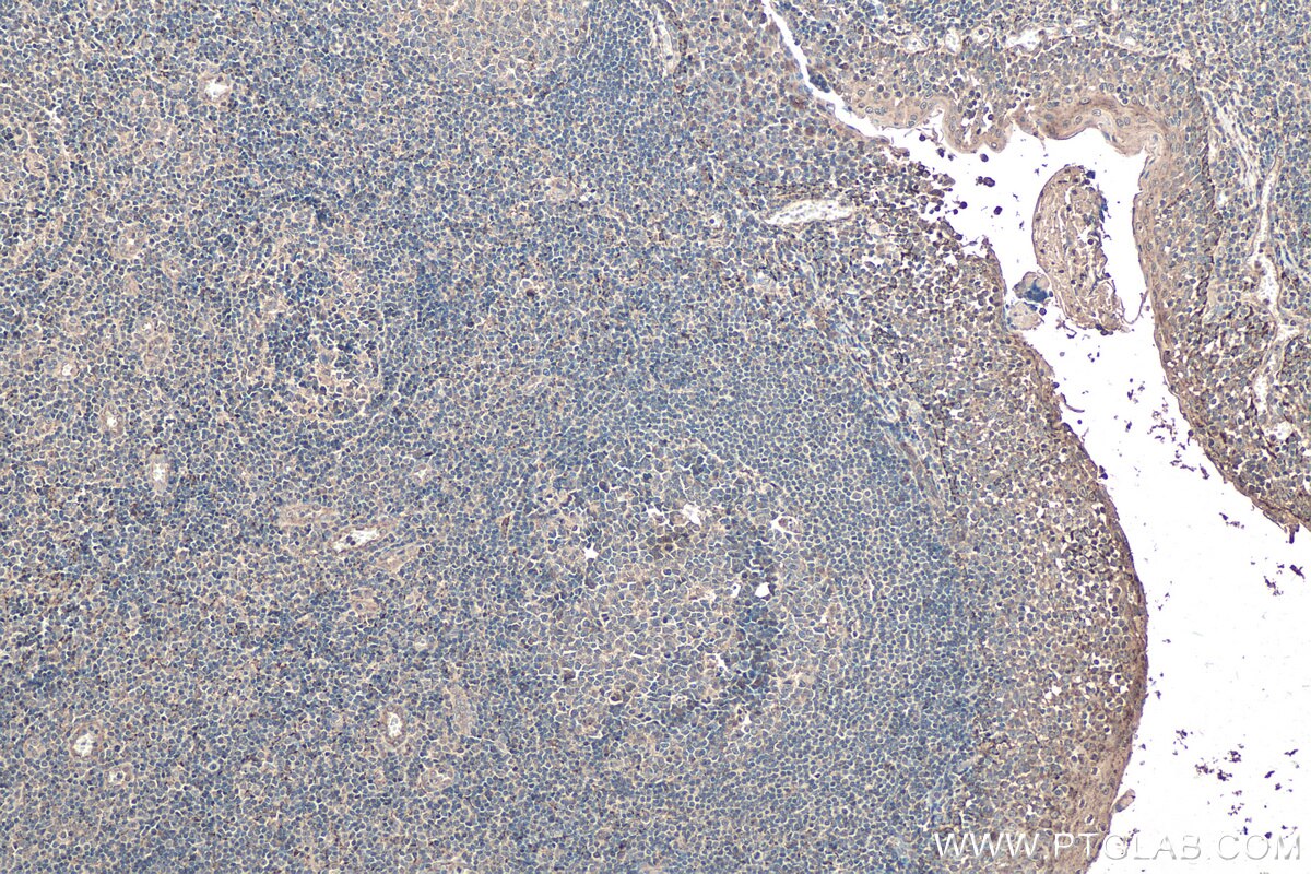 SOX9 antibody (67439-1-Ig) | Proteintech