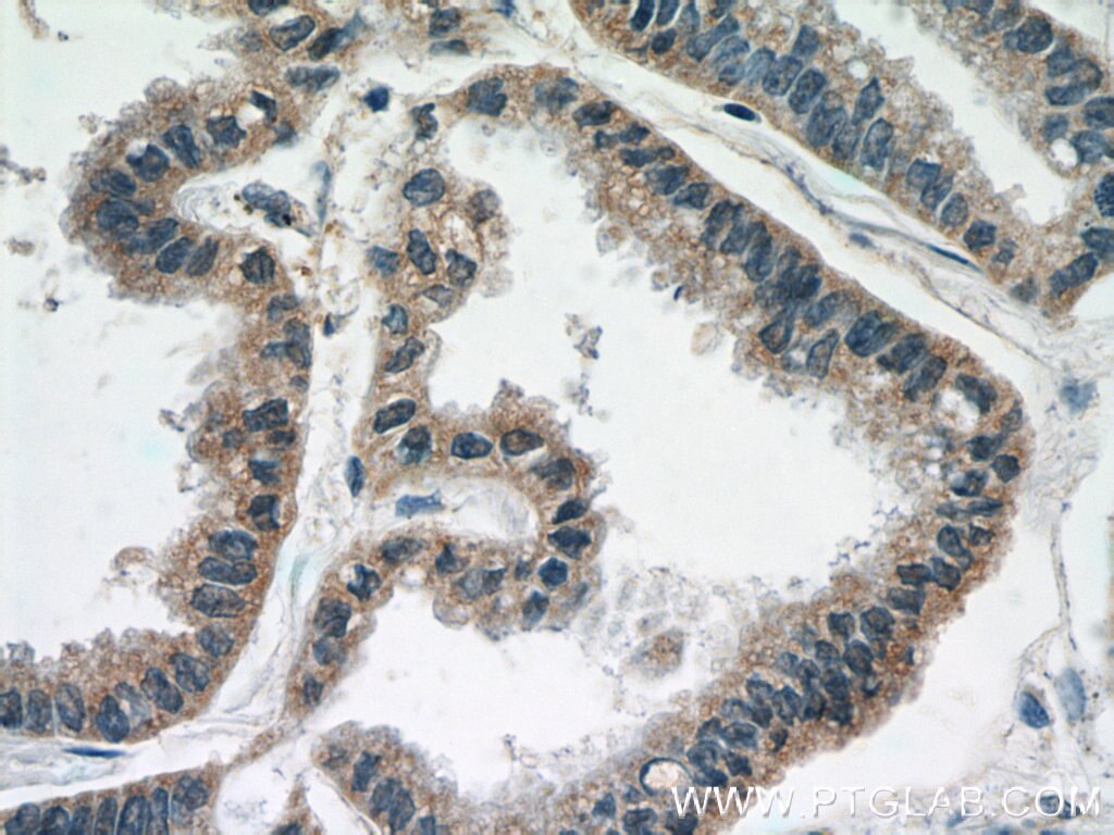 SPIRE1 antibody (11295-1-AP) | Proteintech