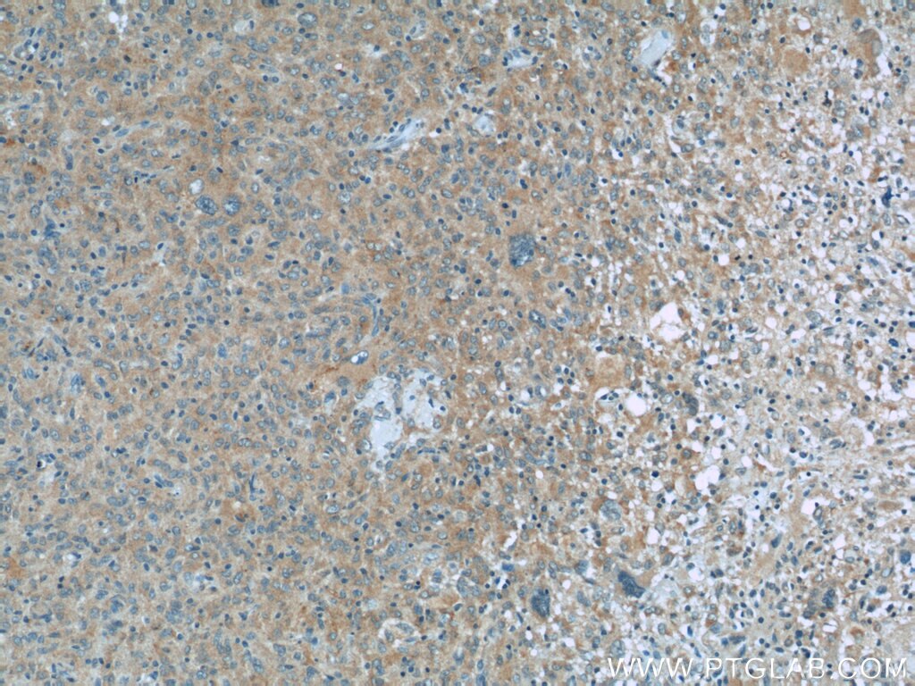 SPIRE1 antibody (11295-1-AP) | Proteintech