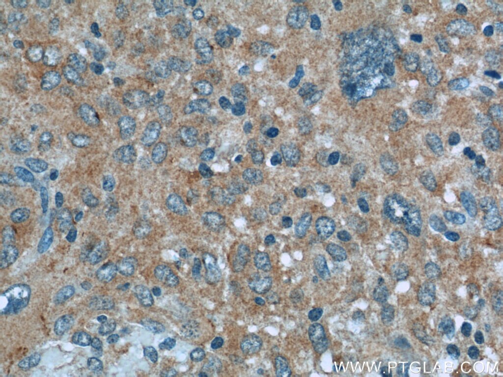 SPIRE1 antibody (11295-1-AP) | Proteintech