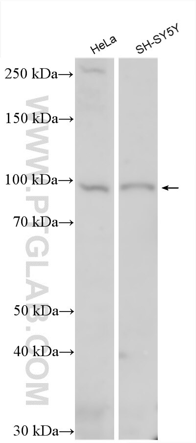 SPIRE1 antibody (11295-1-AP) | Proteintech