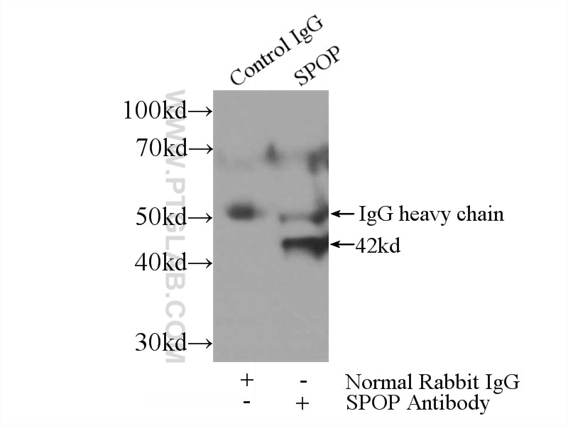 SPOP Fusion Protein Ag10384 | Proteintech