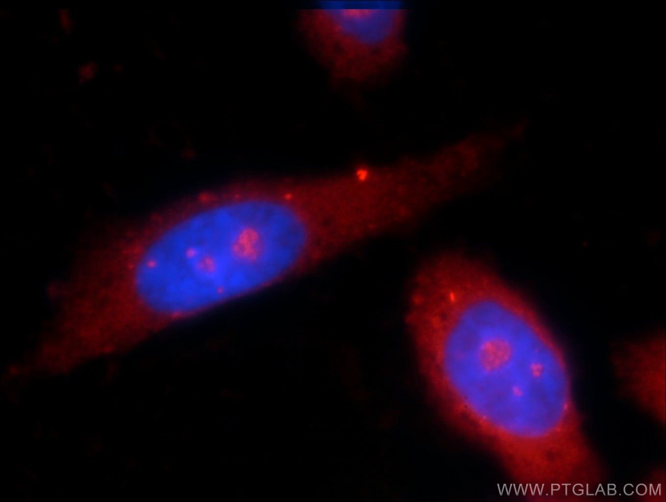 P62;SQSTM1 Fusion Protein Ag13131 | Proteintech