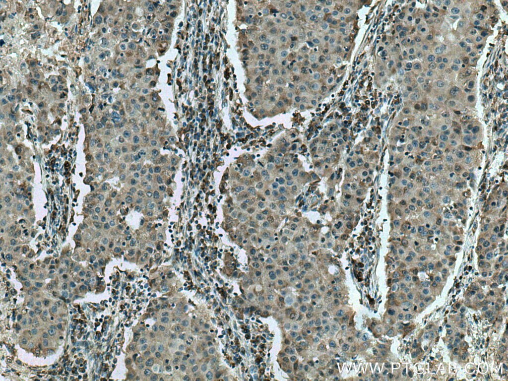 STAT4 Fusion Protein Ag19545 | Proteintech