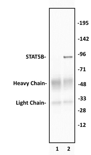 STAT5B antibody (pAb) | Proteintech