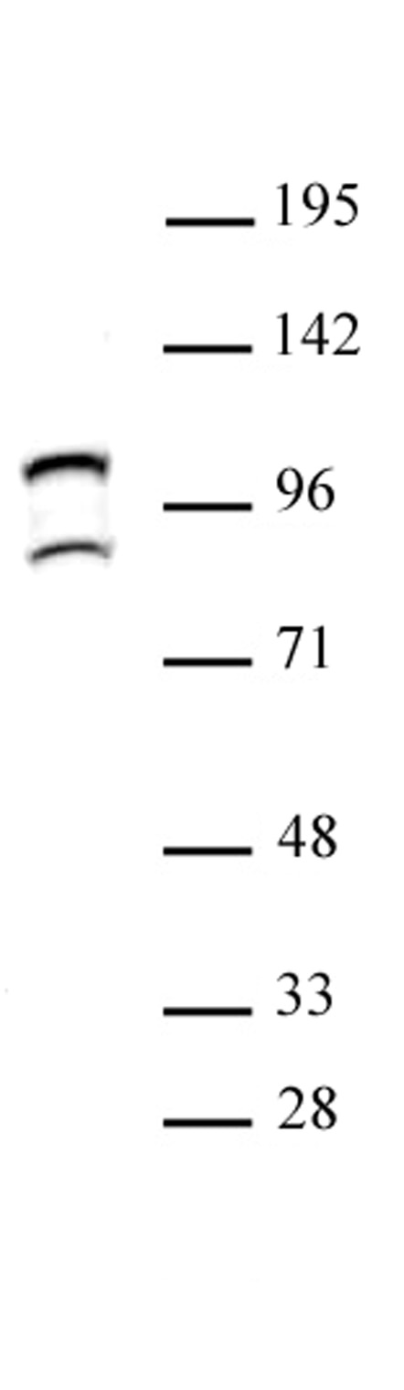 STAT6 antibody (pAb) | Proteintech