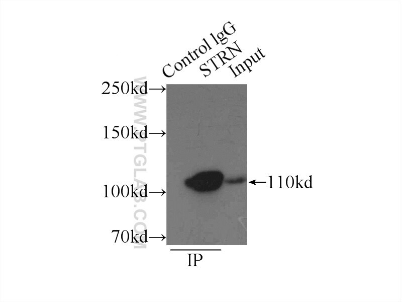 STRN antibody (21624-1-AP) | Proteintech
