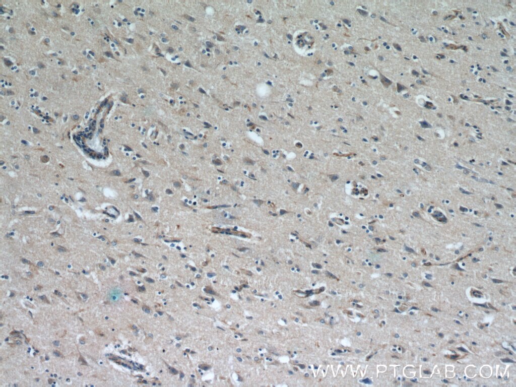 Syntaxin 12 Antibody 14259-1-AP | Proteintech