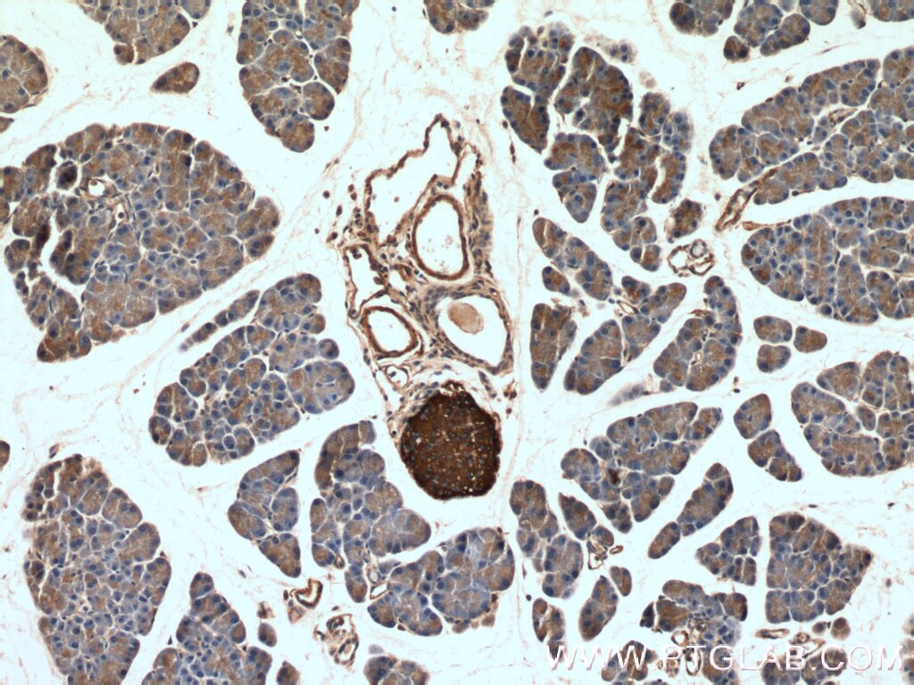 Synaptophysin; SYP Fusion Protein Ag11803 | Proteintech