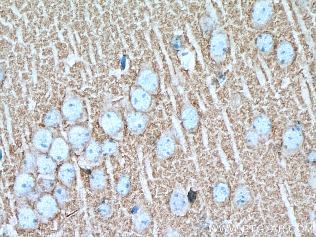 Synaptophysin antibody (17785-1-AP) | Proteintech