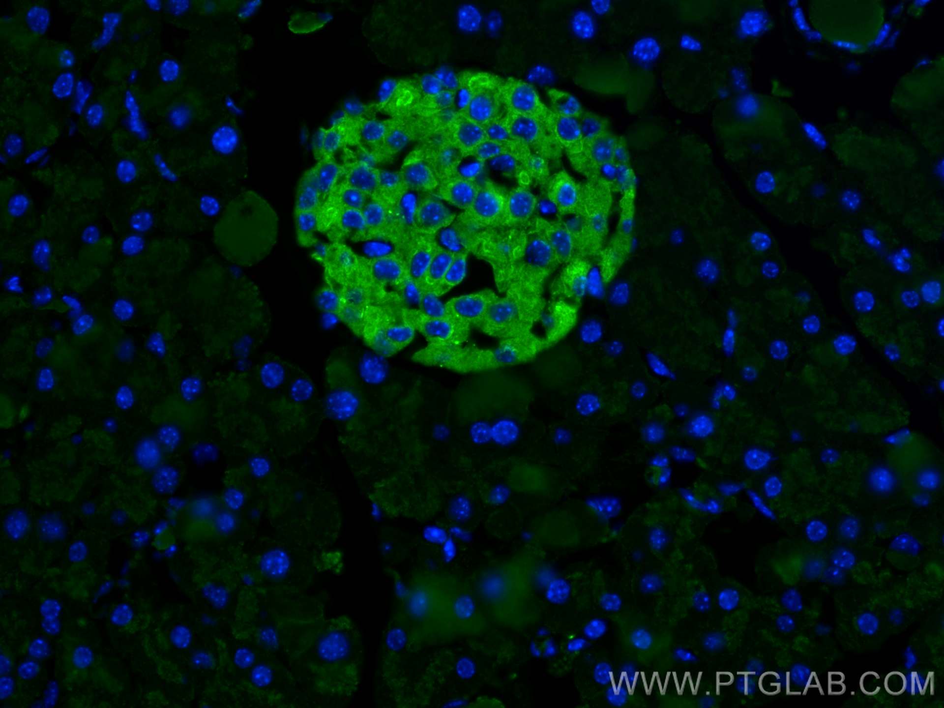 Synaptophysin antibody (67864-1-Ig) | Proteintech