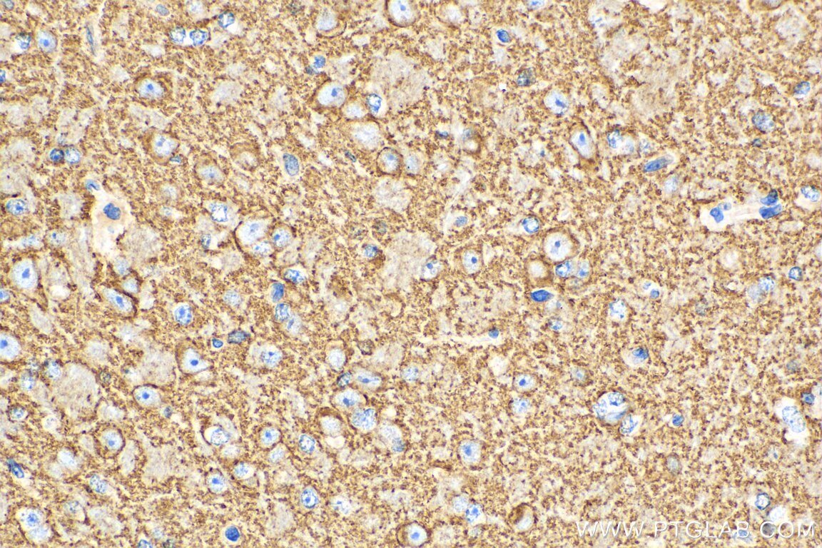 Synaptophysin antibody (67864-1-Ig) | Proteintech