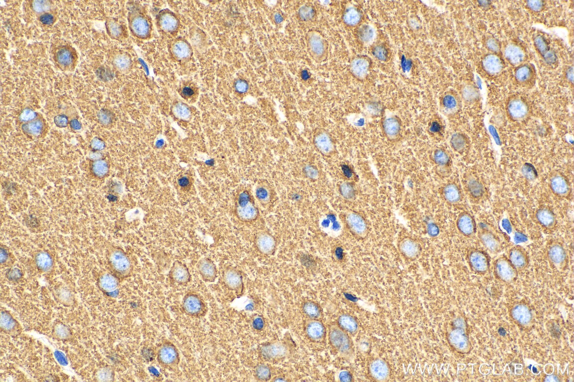 Synaptophysin antibody (67864-1-Ig) | Proteintech