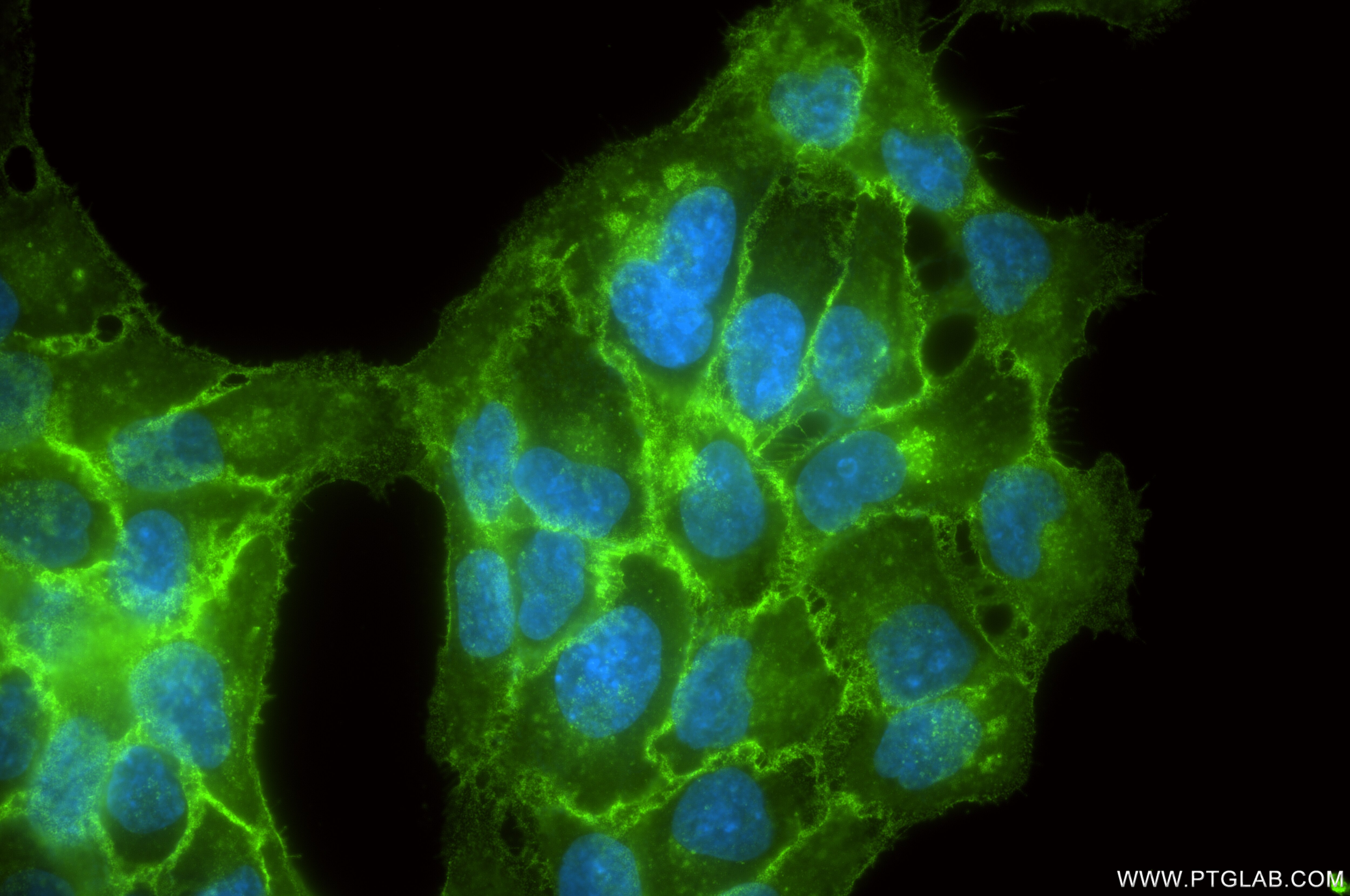 TACSTD2/TROP2 antibody (86155-1-RR) | Proteintech
