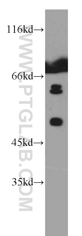 TADA2B antibody (17367-1-AP) | Proteintech