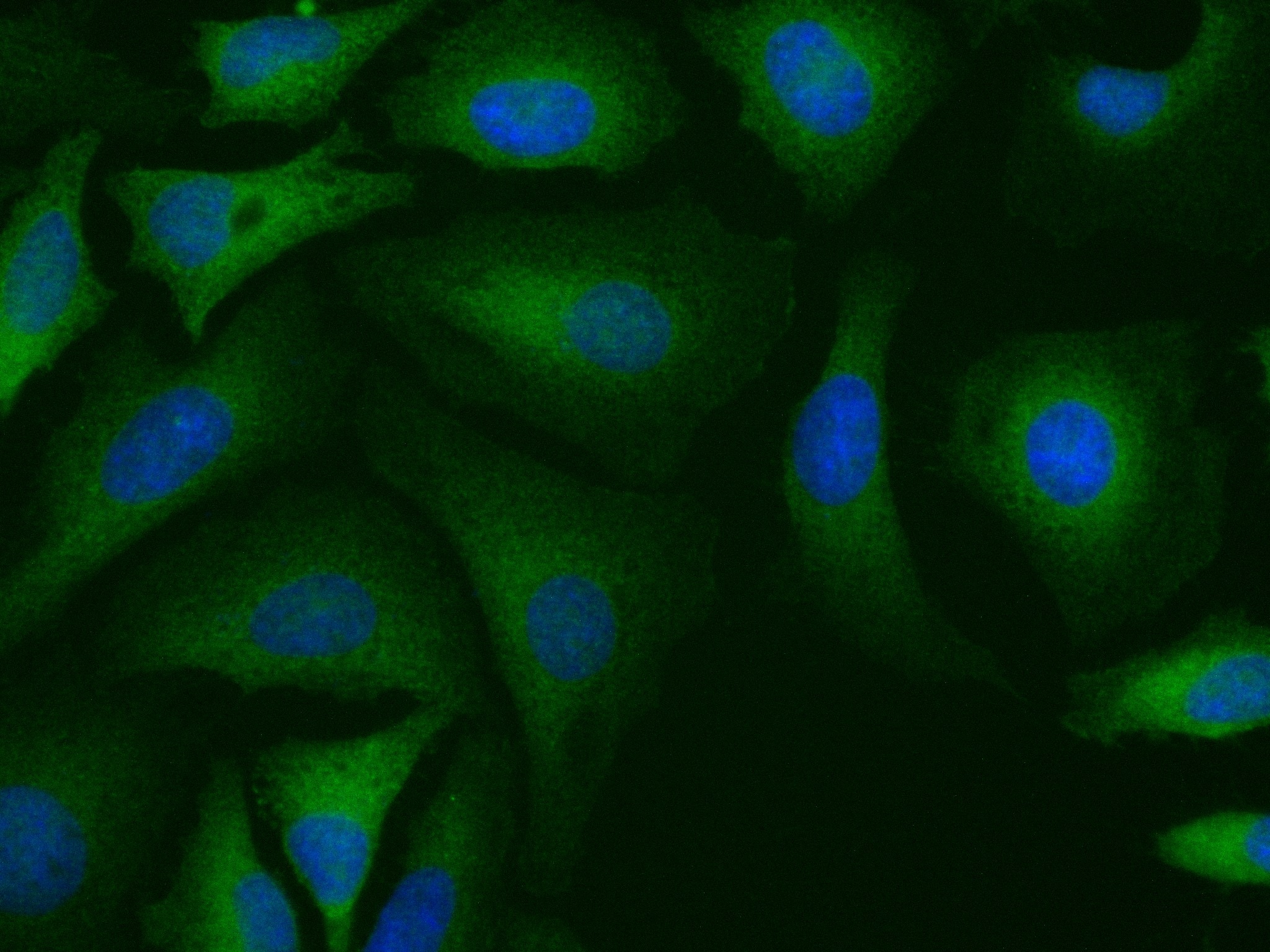 TBCD antibody (82911-2-RR) | Proteintech