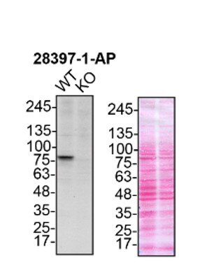 TBK1 antibody (28397-1-AP) | Proteintech